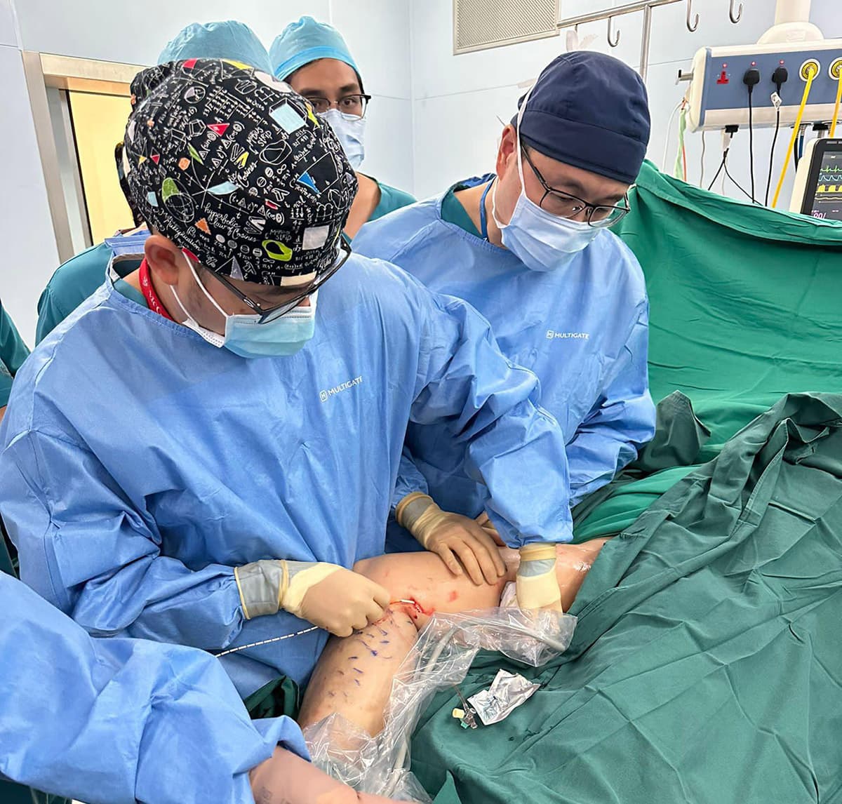 Peripheral Arteriovenous Malformations (AVMs) - The Vascular ...